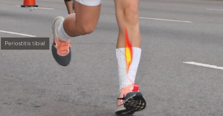 Causes and treatment of tibial periostitis